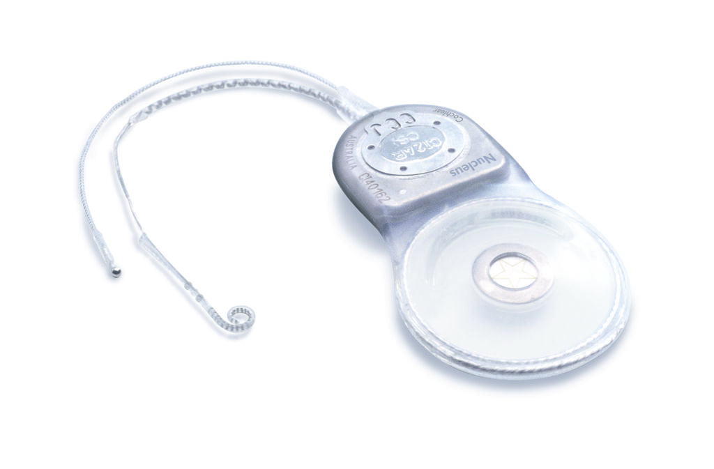 Cochlear Implants - Lifetime Hearing Services